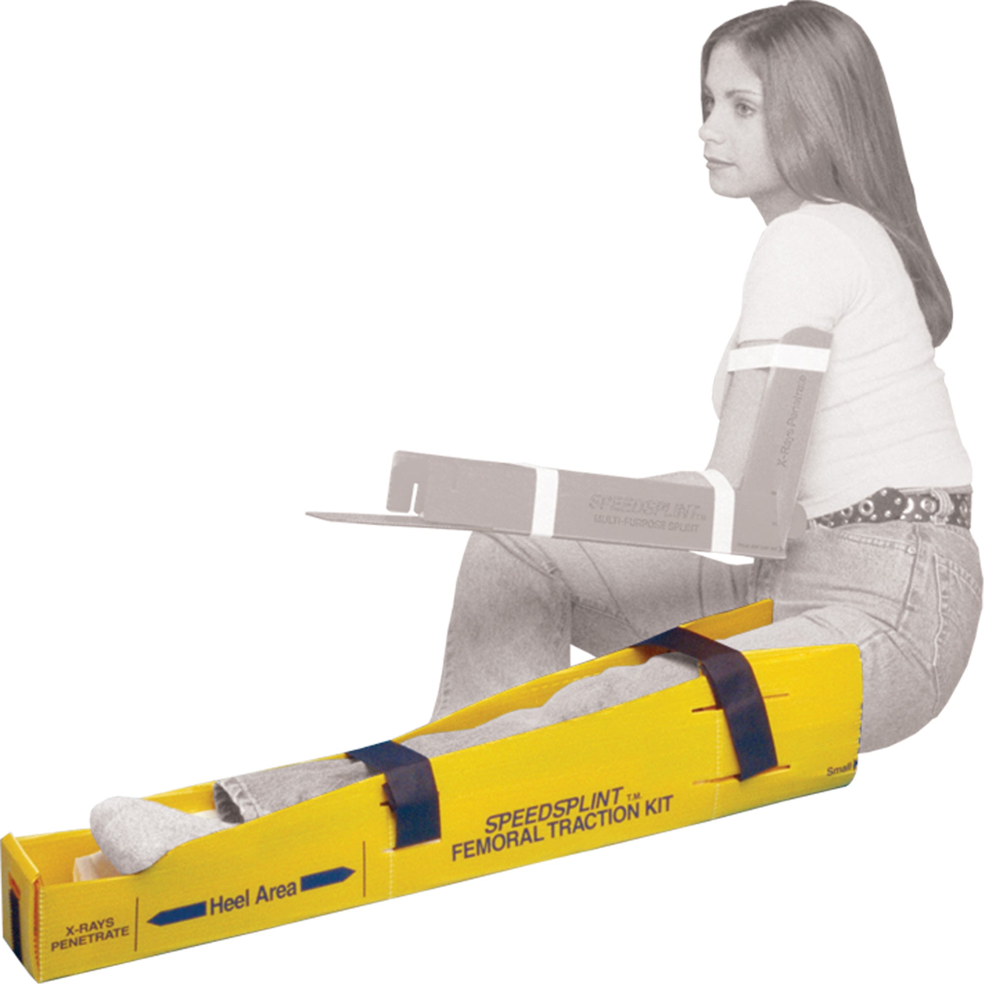 Multipurpose Speedsplint™ - Femoral Traction Kits | Servoxy Inc